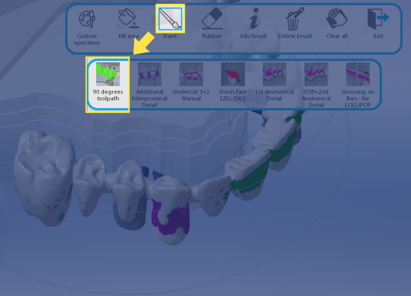 MillBox News - CIMsystem Dental